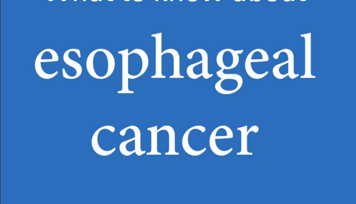 Esophageal cancer: What you should know | MD Anderson Cancer Center