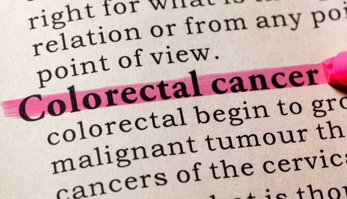 Colorectal cancer screening guidelines: What to know | MD Anderson ...