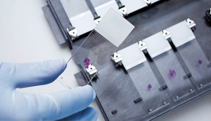 What is minimal residual disease (MRD)? | MD Anderson Cancer Center