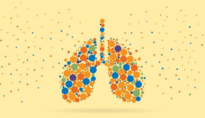 Can immunoprevention stop lung cancer before it starts? | MD Anderson ...