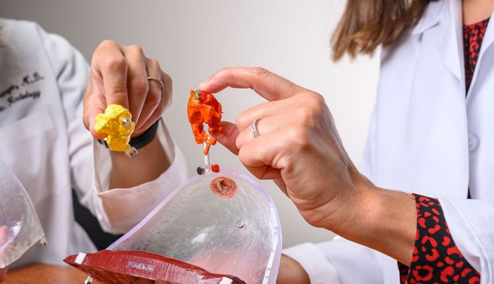 How is 3D printing used for breast cancer treatment? | MD Anderson ...