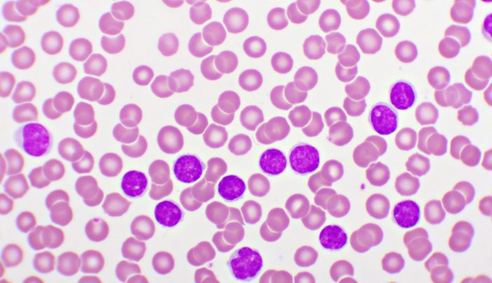 How diversity within a cancer can influence a patient’s response to ...