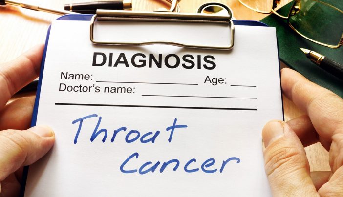 Throat cancer treatment: How it's changing | MD Anderson Cancer Center