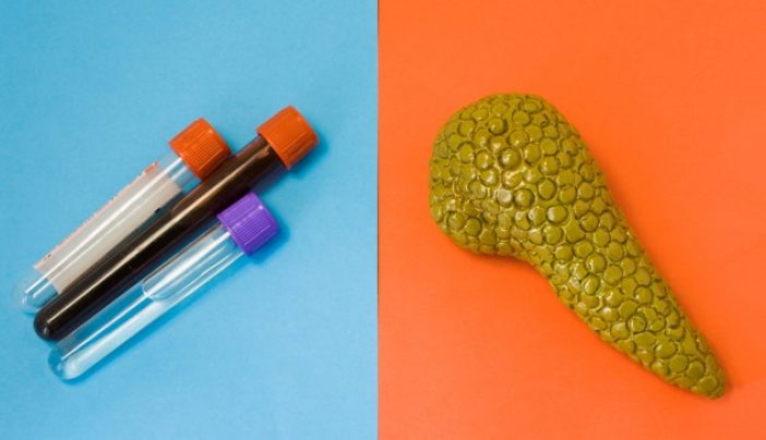 What research is being done to improve early detection of pancreatic ...