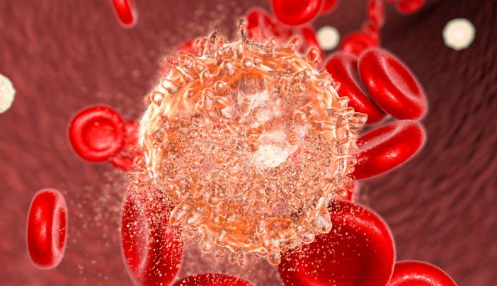 Targeted therapy venetoclax improving acute myeloid leukemia treatment ...