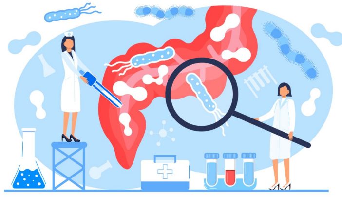 H. pylori and your stomach cancer risk | MD Anderson Cancer Center