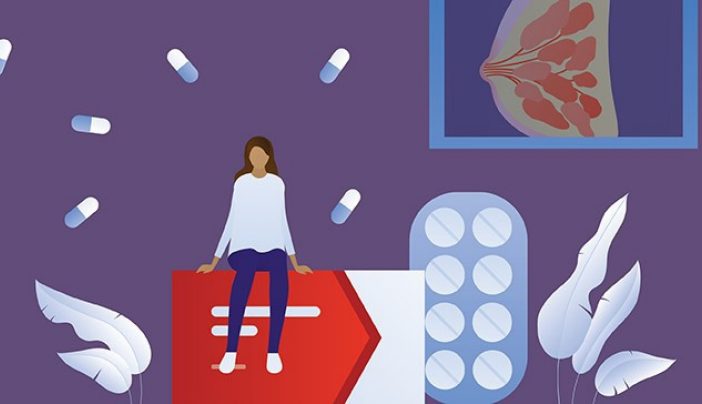 What is hormone therapy for breast cancer? | MD Anderson Cancer Center