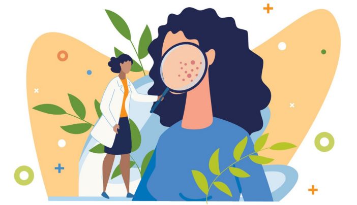 Who’s at increased risk for skin cancer? | MD Anderson Cancer Center