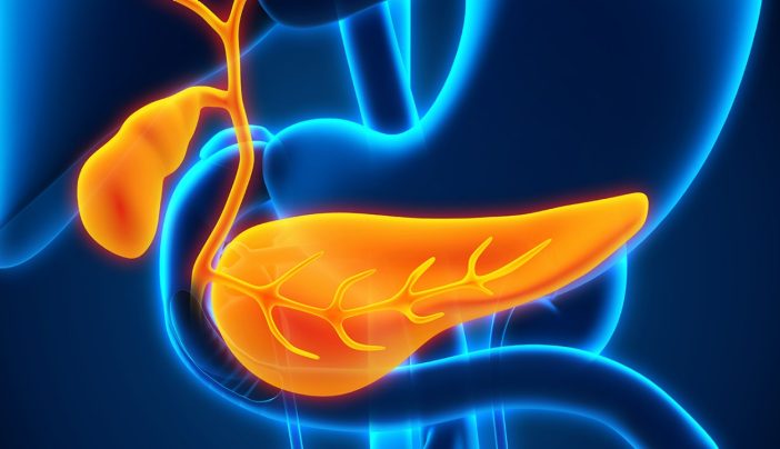 Pancreatic cysts: What they are and how they’re treated | MD Anderson ...