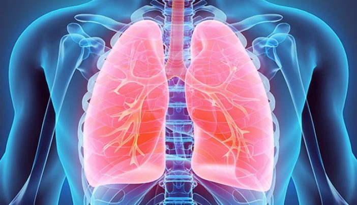 What are Pancoast tumors? | MD Anderson Cancer Center