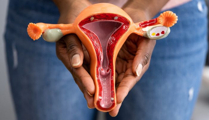 How Is Ovarian Cancer Treated Md Anderson Cancer Center