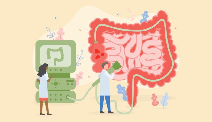 What is a colonoscopy? Your questions, answered | MD Anderson Cancer Center