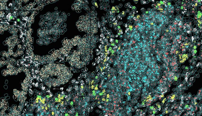 What is spatial profiling? | MD Anderson Cancer Center