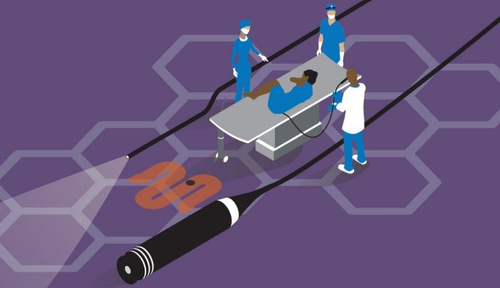 How long does a colonoscopy take? 4 things you should know | MD ...