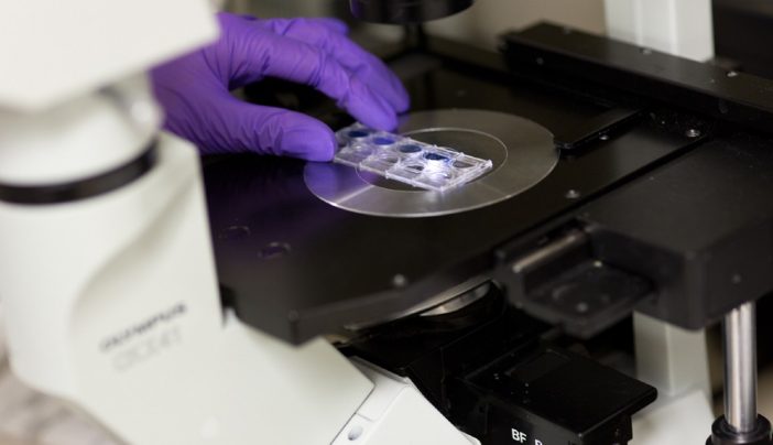 What is a biopsy? 7 questions, answered | MD Anderson Cancer Center