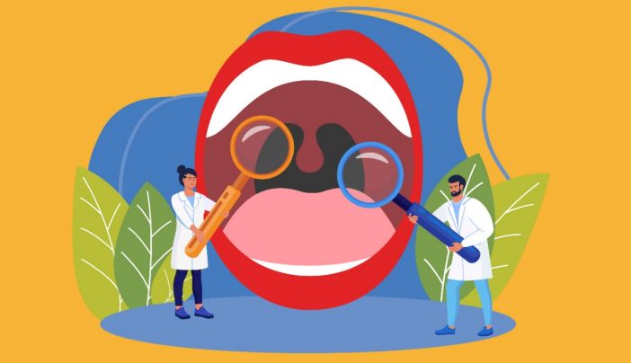 What are the first signs of oral cancer? | MD Anderson Cancer Center