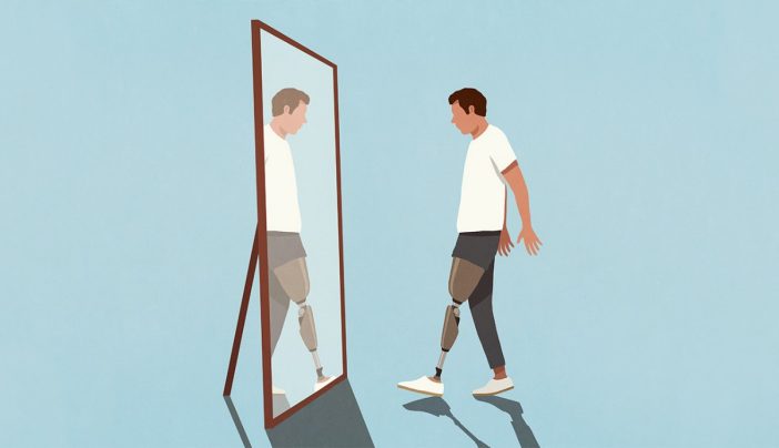 What is phantom limb pain? 5 questions, answered | MD Anderson Cancer Center