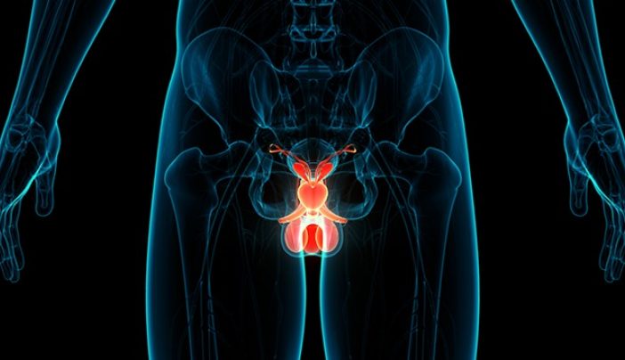Understanding orchiectomies: What you need to know | MD Anderson Cancer ...