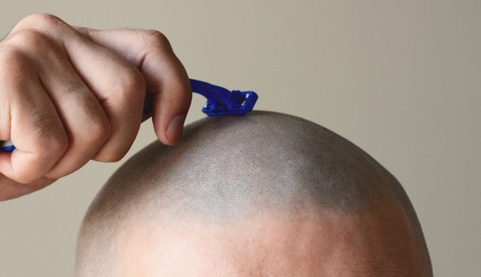 Head shaving and brain surgery: 4 things to know | UT MD Anderson