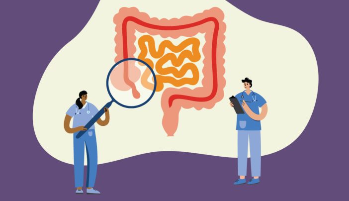 3 reasons appendix cancer is hard to diagnose | UT MD Anderson