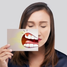 Oral Cancer - Facts, Diagnosis & Treatment | MD Anderson Cancer Center