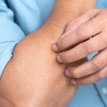 14 Top Lymphoma Symptoms & Signs | MD Anderson Cancer Center