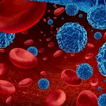 Leukemia: Definition, Types & Risk Factors | MD Anderson Cancer Center