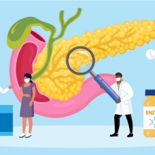 Pancreatic Cancer | Symptoms, Diagnosis & Treatment | MD Anderson ...