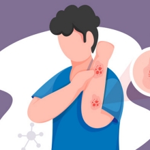 What is Chronic Lymphocytic Leukemia (CLL)? Symptoms, Risk Factors ...