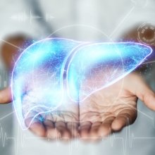 Liver Cancer Screening | MD Anderson Cancer Center