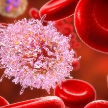 Leukemia: Definition, Types & Risk Factors | MD Anderson Cancer Center