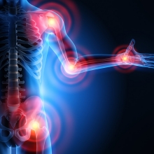 Soft Tissue Sarcoma Symptoms, Facts, Diagnosis, and Treatment | MD ...