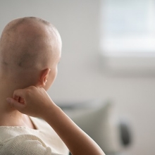Chemotherapy and Hair Loss | MD Anderson Cancer Center