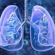 Lung Cancer Diagnosis | MD Anderson Cancer Center