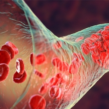 Blood Clots and Anticoagulants | MD Anderson Cancer Center