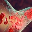 Blood Clots and Anticoagulants | MD Anderson Cancer Center
