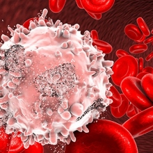 Leukemia: Definition, Types & Risk Factors | MD Anderson Cancer Center