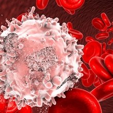 Leukemia: Definition, Types & Risk Factors | MD Anderson Cancer Center