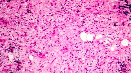 Cancerwise Blog | MD Anderson Cancer Center