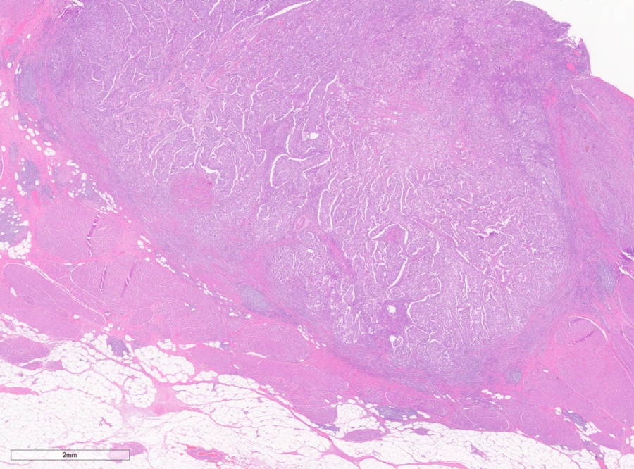 6 Innovative Bladder Cancer Treatment Options | UT MD Anderson