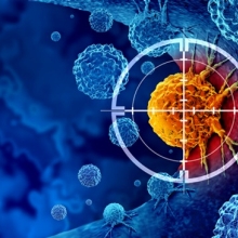 9 Innovative Prostate Cancer Treatment Options | MD Anderson Cancer Center