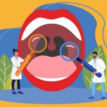 Oral Cancer Stages | MD Anderson Cancer Center