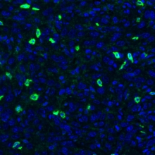 Ma Laboratory News & Media | MD Anderson Cancer Center