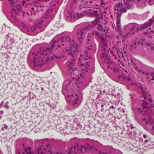 Ma Laboratory News & Media | MD Anderson Cancer Center