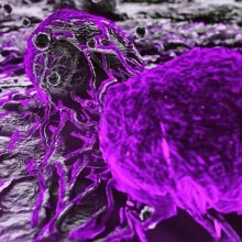 MD Anderson Newsroom | MD Anderson Cancer Center