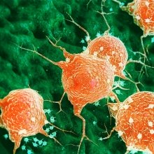 MD Anderson Newsroom | MD Anderson Cancer Center