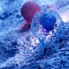 MD Anderson Newsroom | MD Anderson Cancer Center