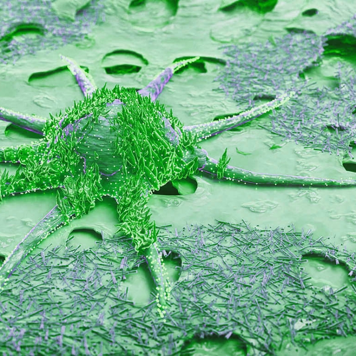 MD Anderson Newsroom | MD Anderson Cancer Center