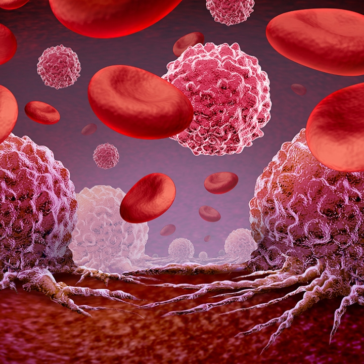 MD Anderson Newsroom | MD Anderson Cancer Center