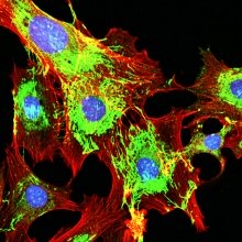 MD Anderson Newsroom | MD Anderson Cancer Center